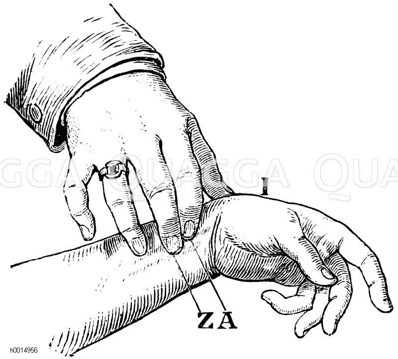 Wie man den Puls fühlt. I) Rücken der linken Hand, ZA) Stelle wo die ...